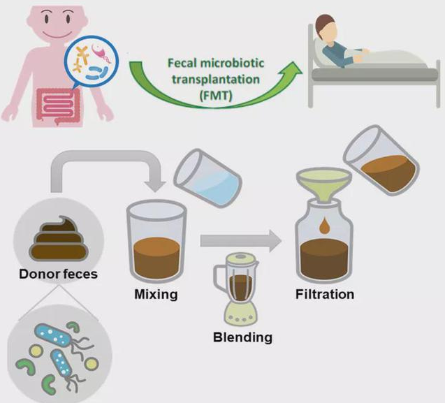 肠菌移植成为癌症治疗领域新突破 - 北京元奥生物技术有限公司